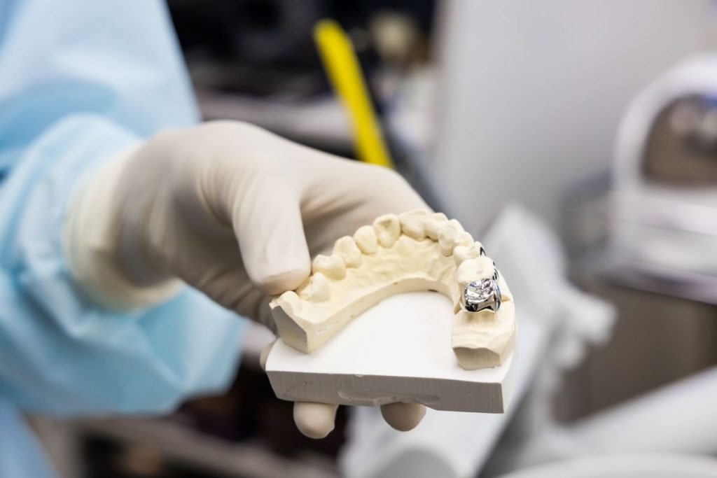 Inlays / Onlays — Rhodes Central Dental